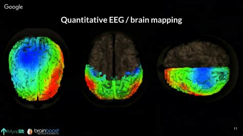 Neurofeedback Brain