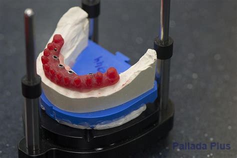 Работа на имплантах Палада плюс