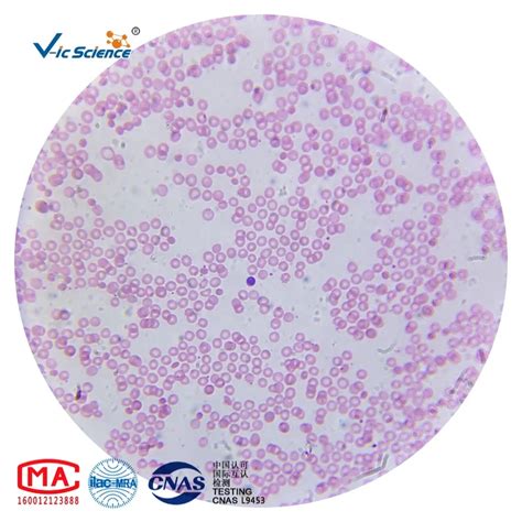 Microscope Prepared Slides Hematology Blood Smears