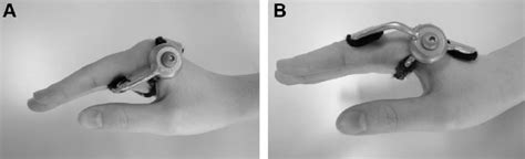 A Flexion Limitation Orthosis And B Extension Limitation Orthosis Download Scientific