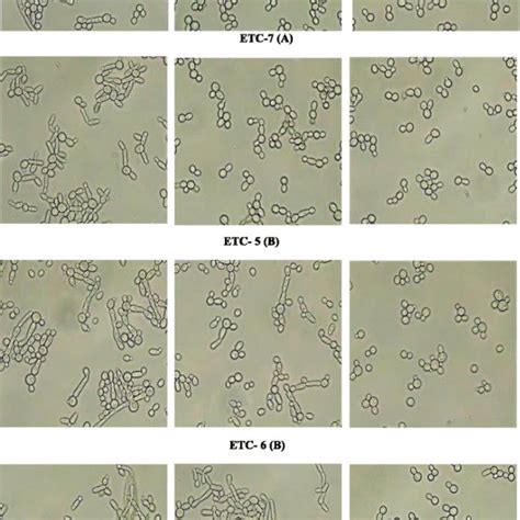 Yeast To Hyphae Transition In Candida Albicans Cells Candida Cells