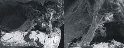 Sem Examination Revealed Fibrous Encapsulation Of The Implant Download High Resolution
