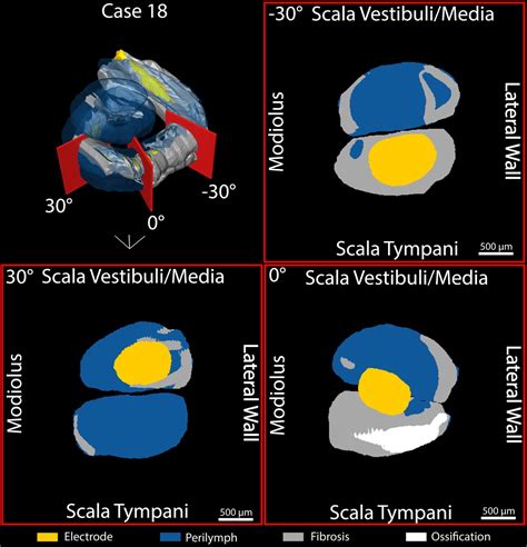 Otology And Neurotology