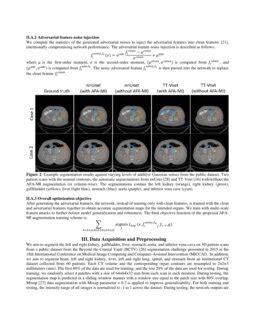 Deep Learning Based Multi Organ Ct Segmentation With Adversarial Data Augmentation Deepai