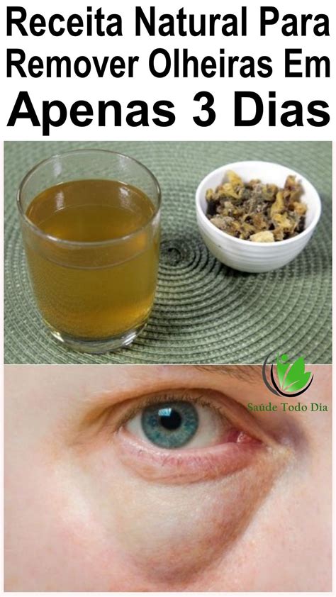 Receita Natural Para Remover Olheiras Em 3 Dias Passo A Passo Dicas