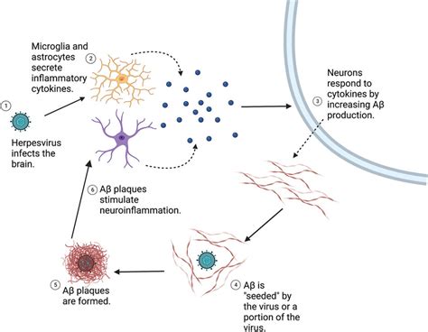 Herpesviruses And The Infectious Origin Hypothesis Of Alzheimers
