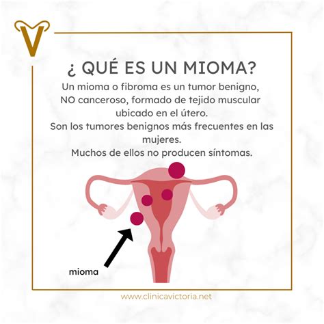 MIOMAS UTERINOS Clínica Victoria