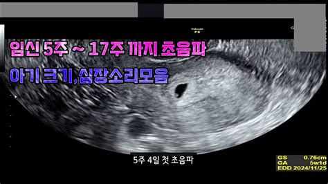 5주차 초음파 17주 초음파 아기크기와 심장소리 YouTube