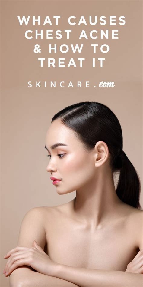 Chest Acne Treatment Artofit