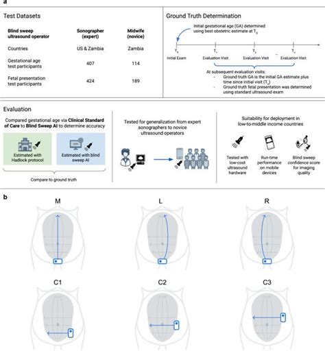 A Mobile Optimized Artificial Intelligence System For Gestational Age