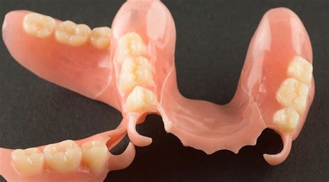 Why Are Valplast Dentures Different • Ascent Dental Care
