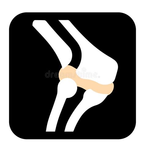 An Anatomically Accurate Diagram Of Human Joint Bones Stock Illustration Illustration Of