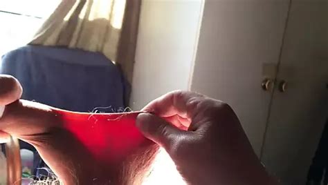 Sunshine Foreskin 3 Of 8 Free Amateur Gay Cock Hd Porn E0 Xhamster