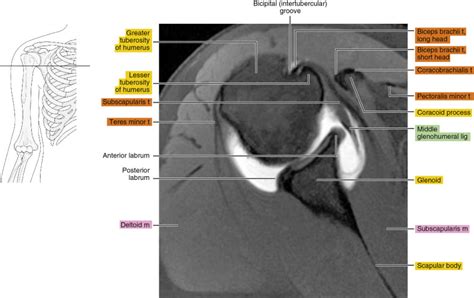Mr Arthrography Of The Shoulder Clinical Tree Mr Arthrography Of The Shoulder Clinical Tree
