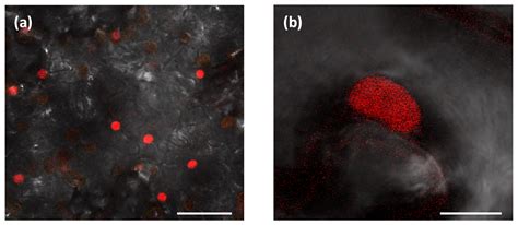 Agrobacterium Microscope
