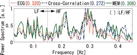Fft Spectrum Of The Hrv In Relaxed State Download Scientific Diagram