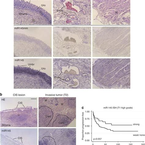 R 145 Expression In Clinical Samples Of Normal Bladder Biopsies