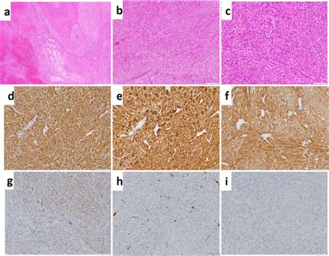 Histopathological Findings 1 Hematoxylin And Eosin Staining Showing
