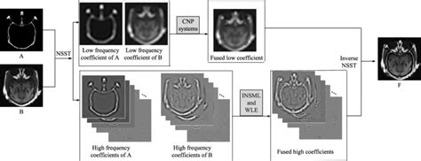 The Proposed Fusion Framework Based On Cnp Systems In Nsst Domain For