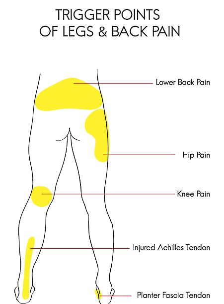 Symptoms Of Sciatica Buttock