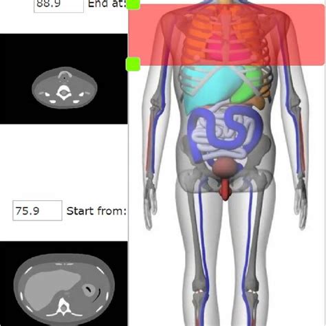 The Scan Range From Chest Ct On 5 Y Old Male Phantom The Scan Range Download Scientific