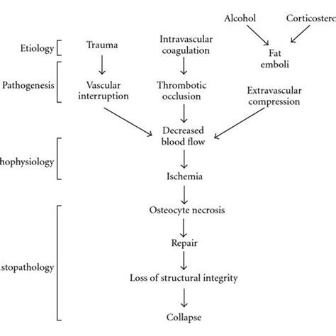 Schematic Representation Of The Development Of Osteonecrosis
