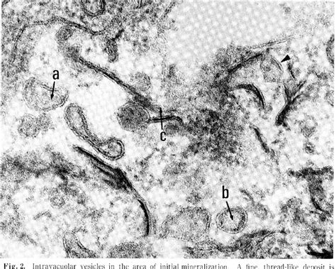 Figure 2 From Ectopic Mineralization In Fibroblast Cultures Semantic