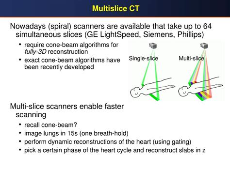 Ppt Cse 337 Introduction To Medical Imaging Lecture 6 X Ray
