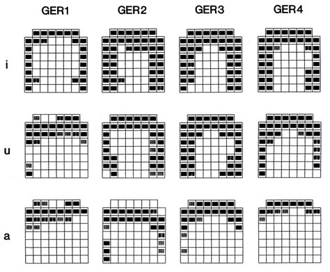 Linguopalatal Contact Configurations At The L Closure Midpoint In