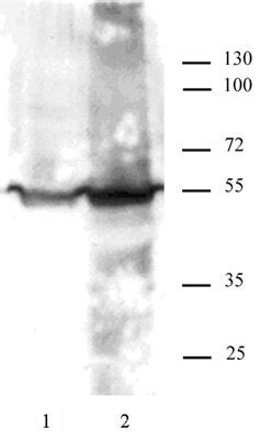 KLF4 antibody (pAb) | Proteintech