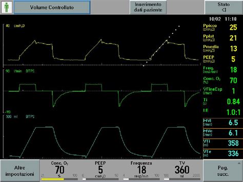 Ventilazione Meccanica Come Scegliere La Best Peep In Situazioni