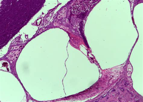 Solved Identify Organ Of Corti Scala Vestibuli Scala