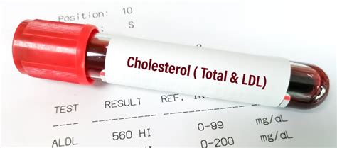 HDL Vs LDL Cholesterol Understanding The Differences HealthAssure