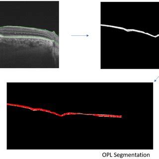 Illustrates The Segmentation And Cropping Of The Outer Plexiform Layer Download Scientific