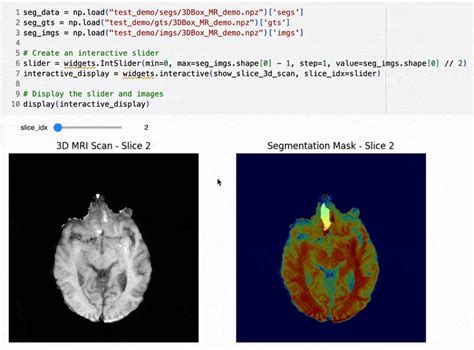 The Ultimate Guide To Medical Image Segmentation With Deep Learning 2d