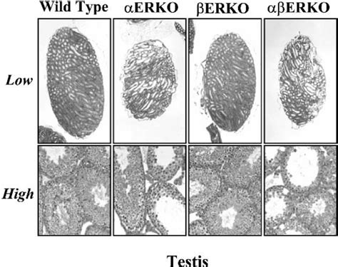 Reproductive Phenotype In The Testis Of Adult Wildtype ␣ Erko ␤ Erko