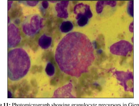 Figure 11 From Gross Pathology Of Small Ruminants Affected With Anaemia