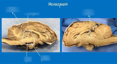 Exam 5 Mesencephalon Diagram Quizlet