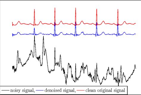 Figure 3 From A Neural Network Approach To Ecg Denoising Semantic Scholar