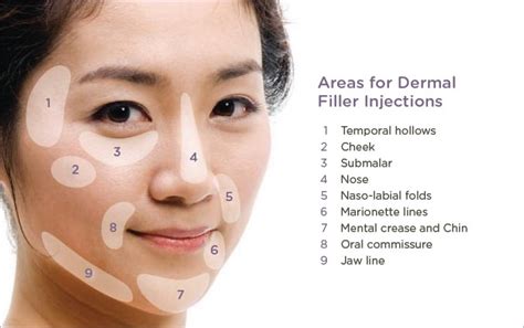 Frequently Asked Questions About Dermal Fillers Cosmetique Aesthetics