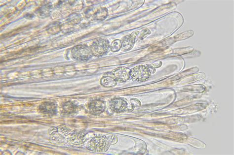 Scutellinia sp アラゲコベニチャワンタケ属 No 001