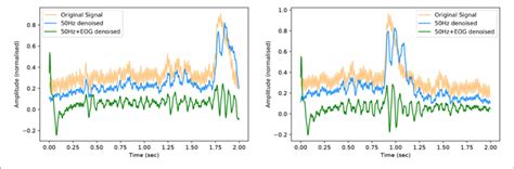Denoised Eeg Signals Following 50 Hz And Eog Artefact Removals Download Scientific Diagram