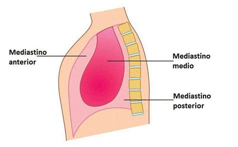 Cuáles son alteraciones frecuentes del mediastino