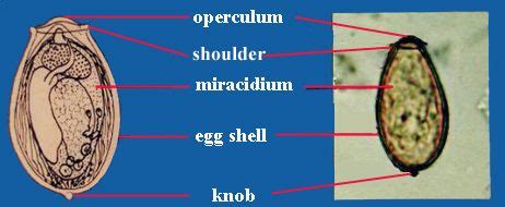 Opisthorchis Viverrini Egg