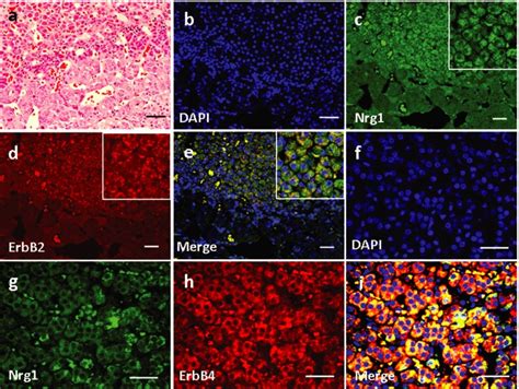 A H And E Staining B I Double Immunofluorescence Staining For Nrg1