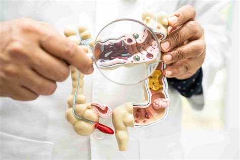 Navigating The Road To Recovery After Colonoscopy