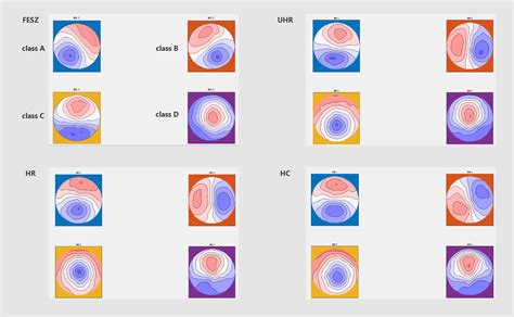 Biomarkers For Schizophrenia Prediction Insights From Resting State Eeg Microstates