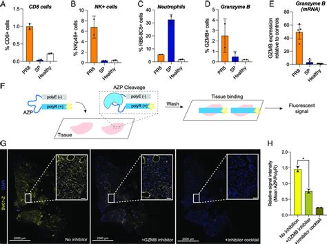 Gzmb Is Elevated In Viral Pneumonia And Contributes To Nanosensor Download Scientific Diagram