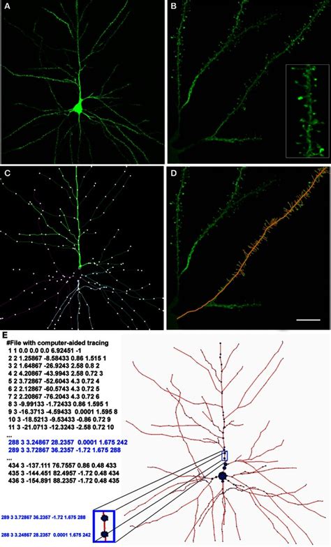 A Confocal Microscopy Image Of An Intracellularly Injected Layer Iii