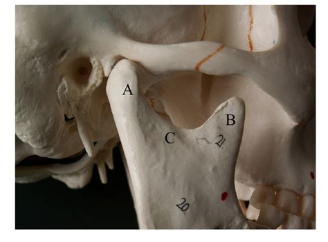 Mandible Maxilla Face Diagram Quizlet